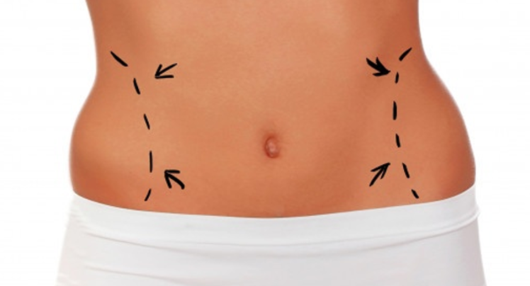 Falando sobre Vibrolipo, saiba tudo!! - Clinica Cirurgia Plástica Dr ...